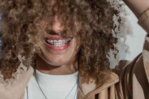 How Long Do Braces Take Tips Duration And More